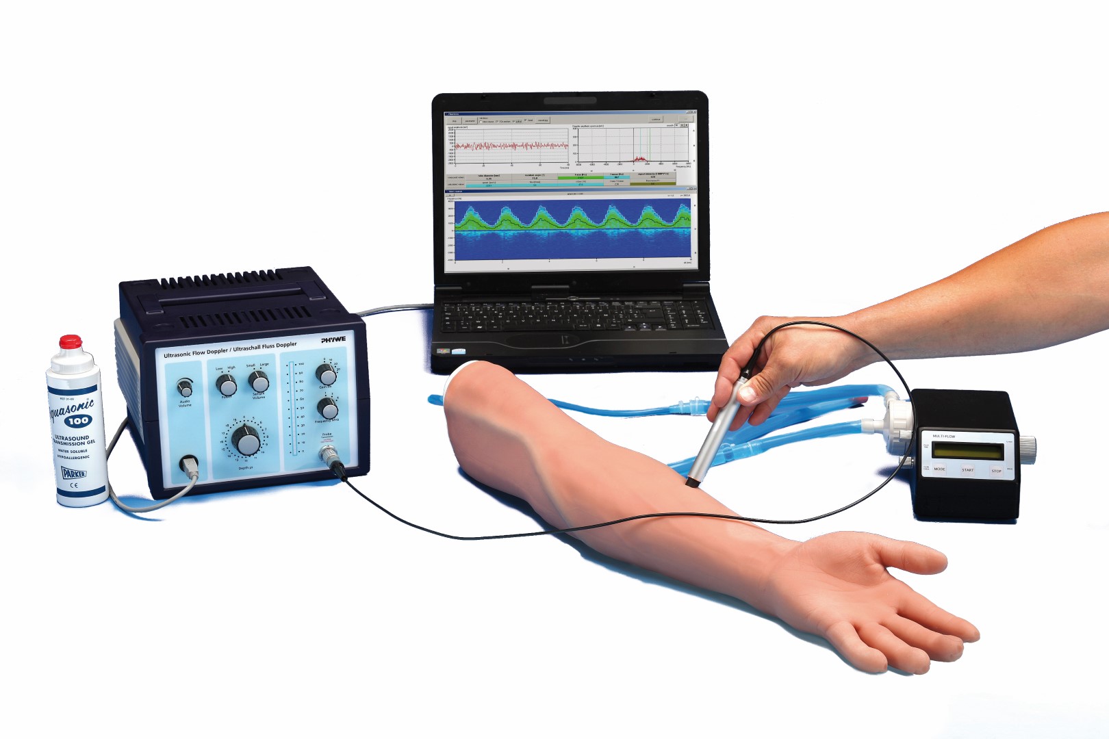 Doppler ultrasound - Radiology, ultrasound, mammography